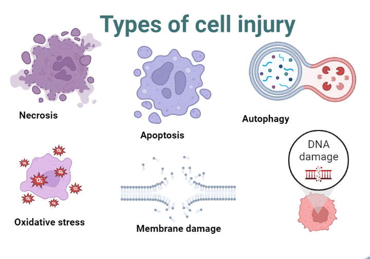 Cell Injury Chapter Notes - Pathology - NEET PG PDF Download