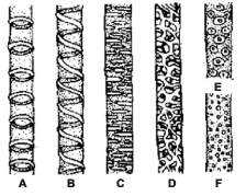 The following diagrams show the types of secondary thickenings in the ...